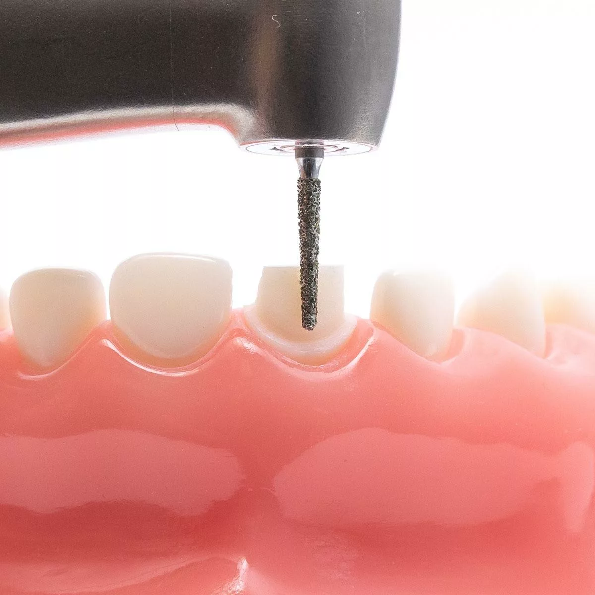 EZPrep Diamond Bur Refills - Sprig Oral Health Technologies, Inc. Store